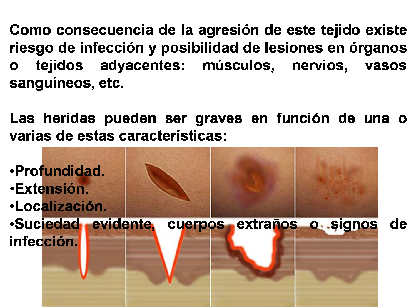 HERIDAS: HERIDAS Y CONTUSION
