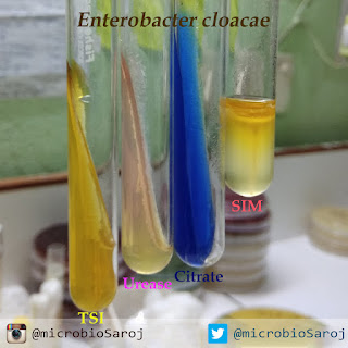 MICROBIOLOGY BLOG FOR STUDENTS (MBLOGSTU): Cultural and Biochemical ...