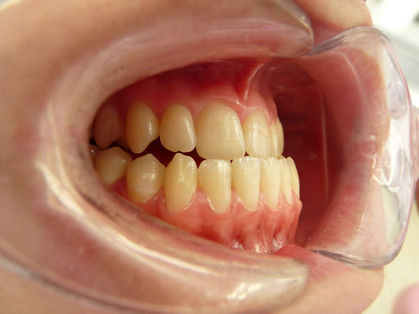 FRENKENKLINIK: Beitrag 106 aus der FRENKENKLINIK: Progenie