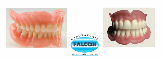 Laboratorio Dental Martin Falcon: PROTESIS TOTALES