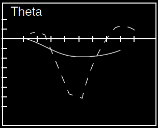 Put Ratio BackSpread Options Greeks: Delta, Gamma, Rho, Vega, Theta ...