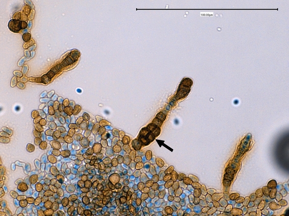Fun With Microbiology (What's Buggin' You?): Phoma glomerata