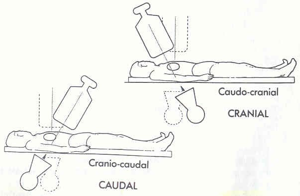 Pedi cardiology: Cath: Caudo-cranial vs. Cranio-caudal projection