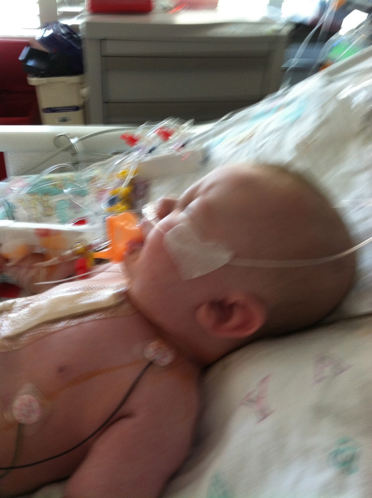 Swope World: Glenn Procedure