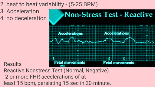 non stress test and contraction stress test | Mr SHYAM