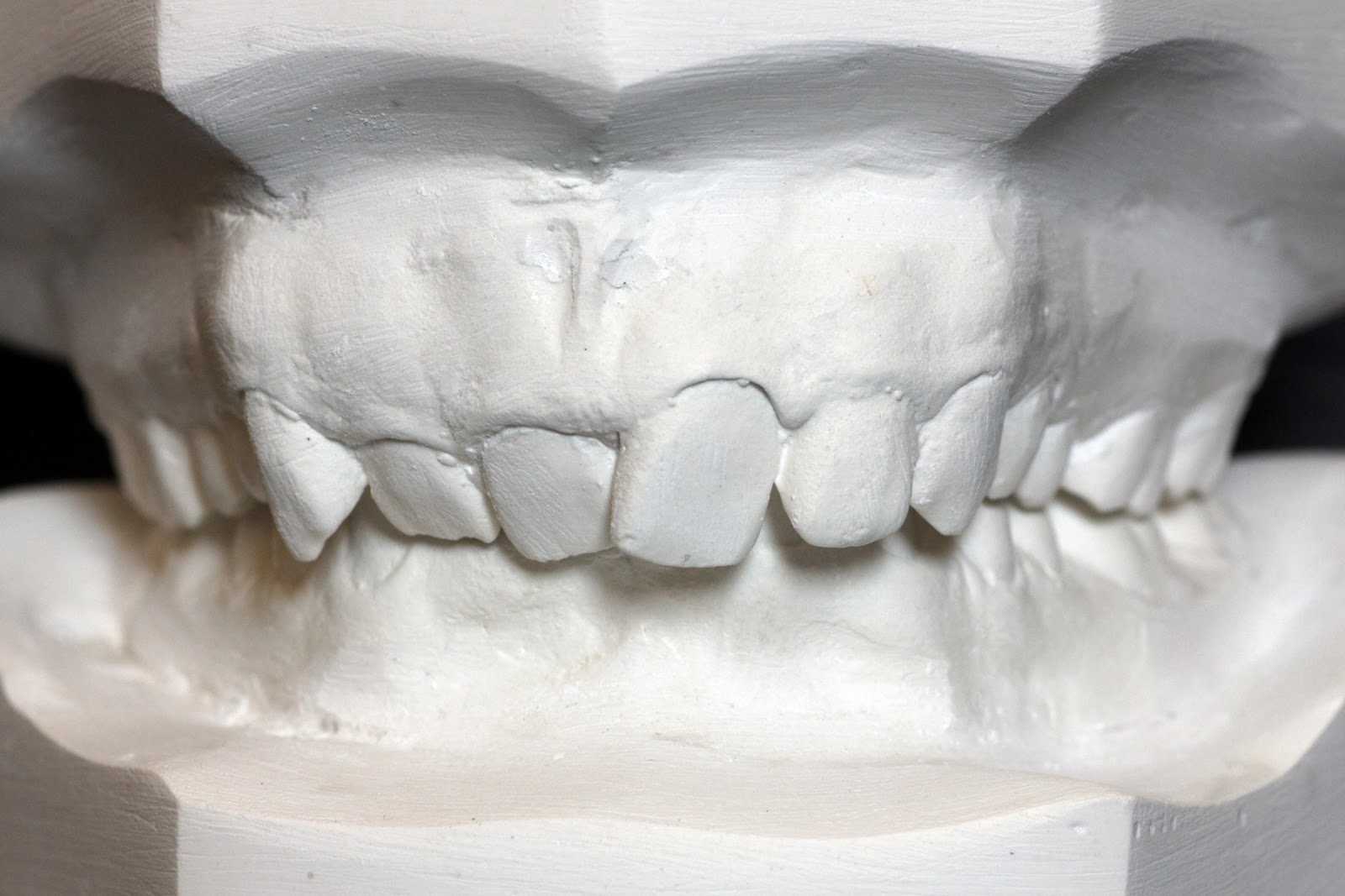 Orthodontics: October 2013