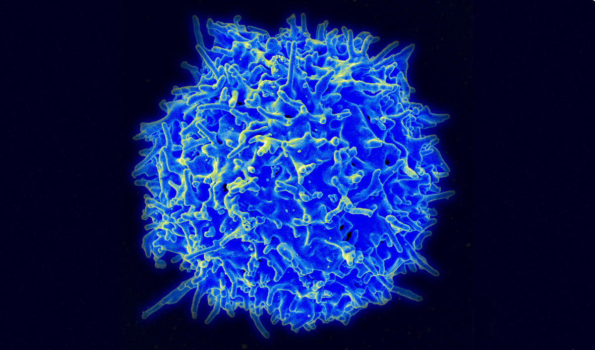 Sistema inmune : leucocito: Linfocito B & Linfocito T