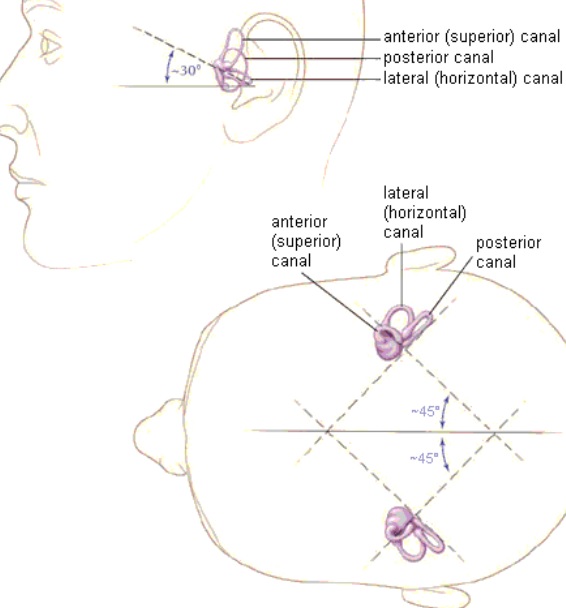 Study Notes: BPPV (Benign paroxysmal positional vertigo)