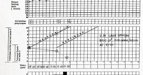 Cara Mengisi Partograf