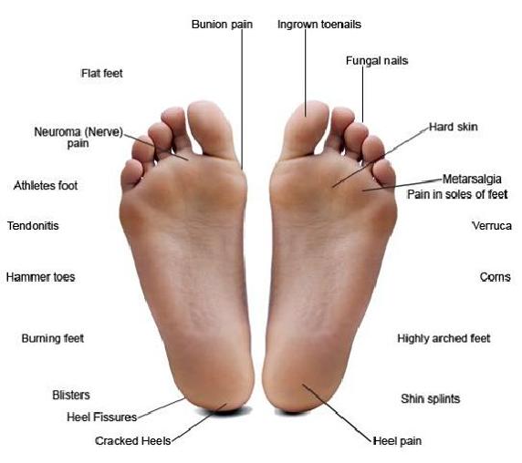 Signs & Complications of Diabetes Foot Problems for Diabetic Patients ...