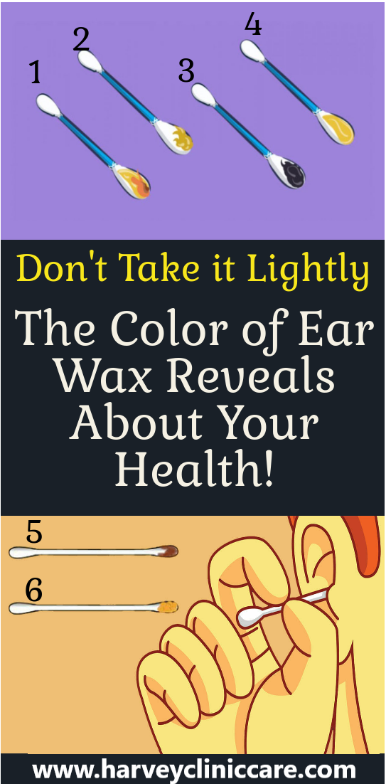 The Color Of Your Earwax Reveals How Healthy You Are ! - Healthy Lifestyle