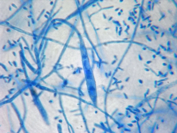Fun With Microbiology (What's Buggin' You?): Microsporum audouinii