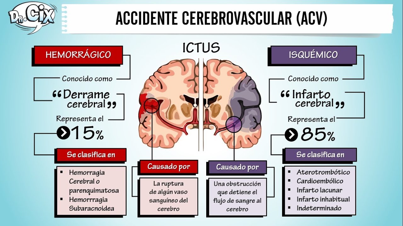 Accidente cerebrovascular (ACV)
