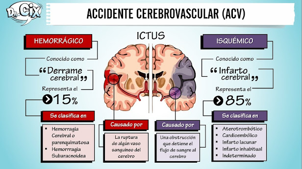 Accidente cerebrovascular (ACV)