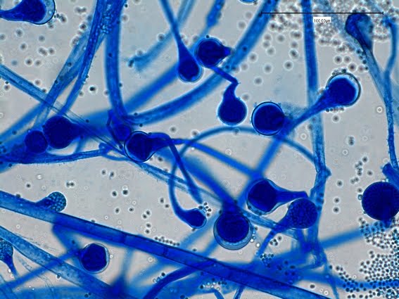 Fun With Microbiology (What's Buggin' You?): Absidia corymbifera ...