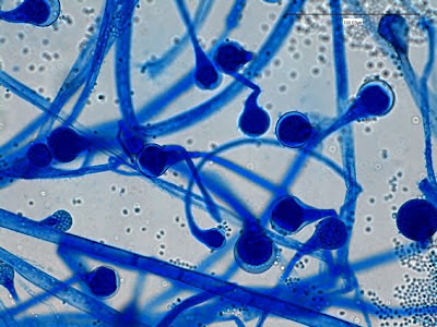 Fun With Microbiology (What's Buggin' You?): Absidia corymbifera ...