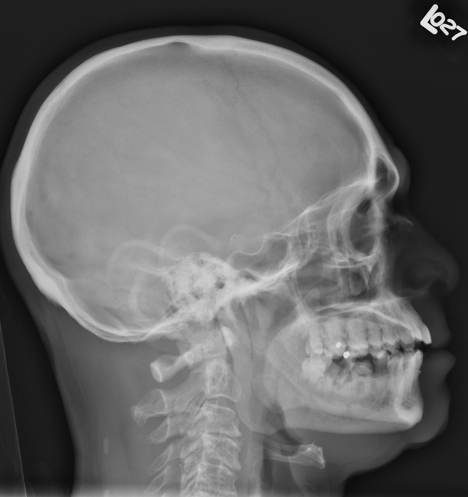 Radiology Squad: TEKNIK PEMERIKSAAN CRANIUM