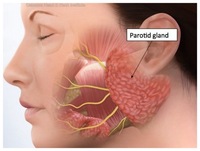 Beguk, sejenis penyakit yang disebabkan oleh jangkitan virus!