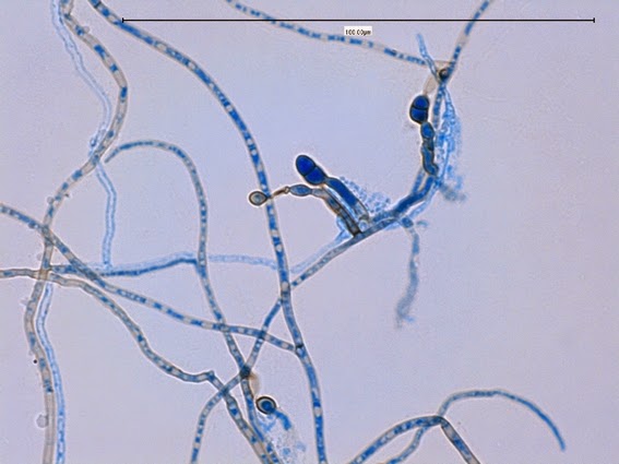 Fun With Microbiology (What's Buggin' You?): Ochroconis species