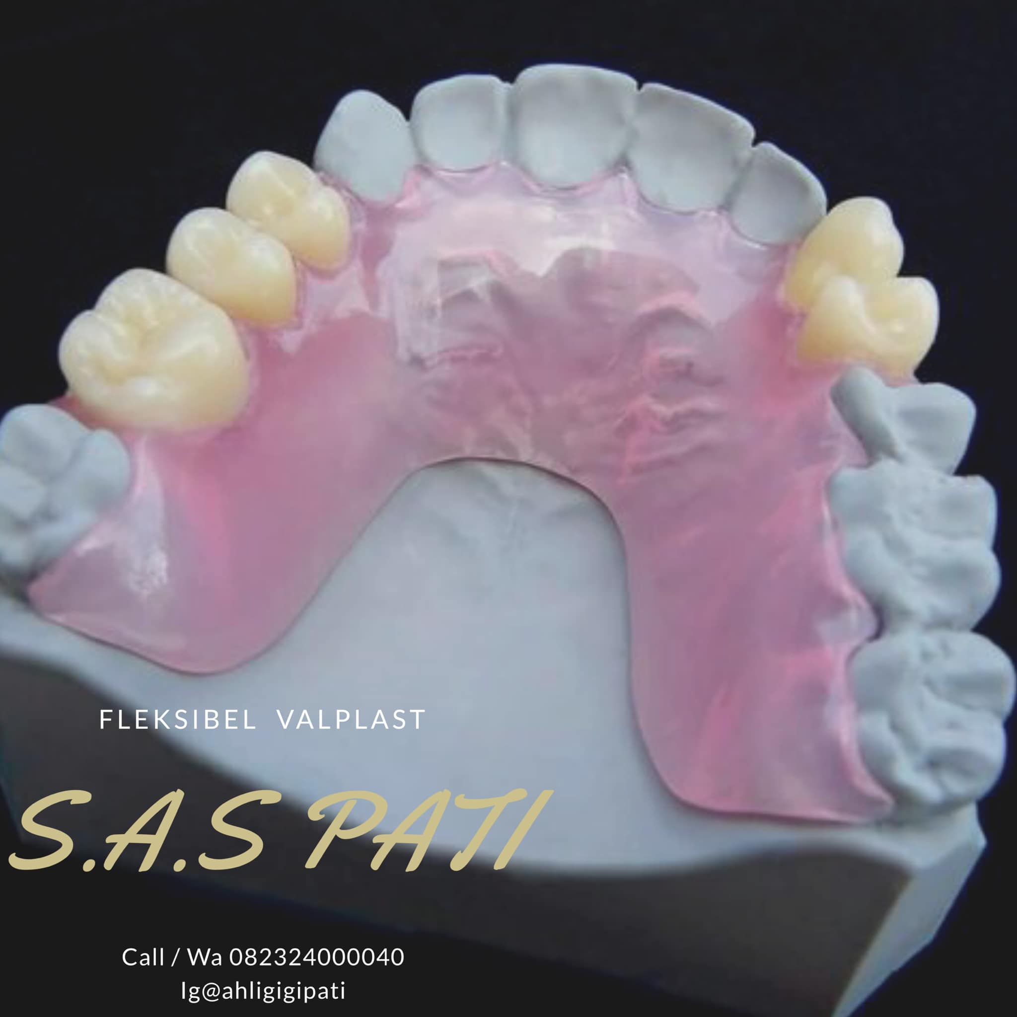Contoh Gigi Tiruan Lepasan / Lepas Pasang Fleksi Bahan Valplast | Anti ...