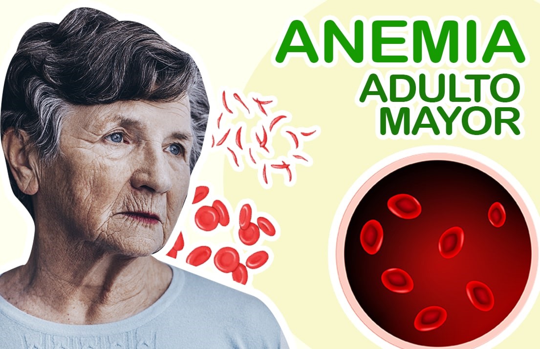 ¿Qué es la anemia en el adulto mayor?