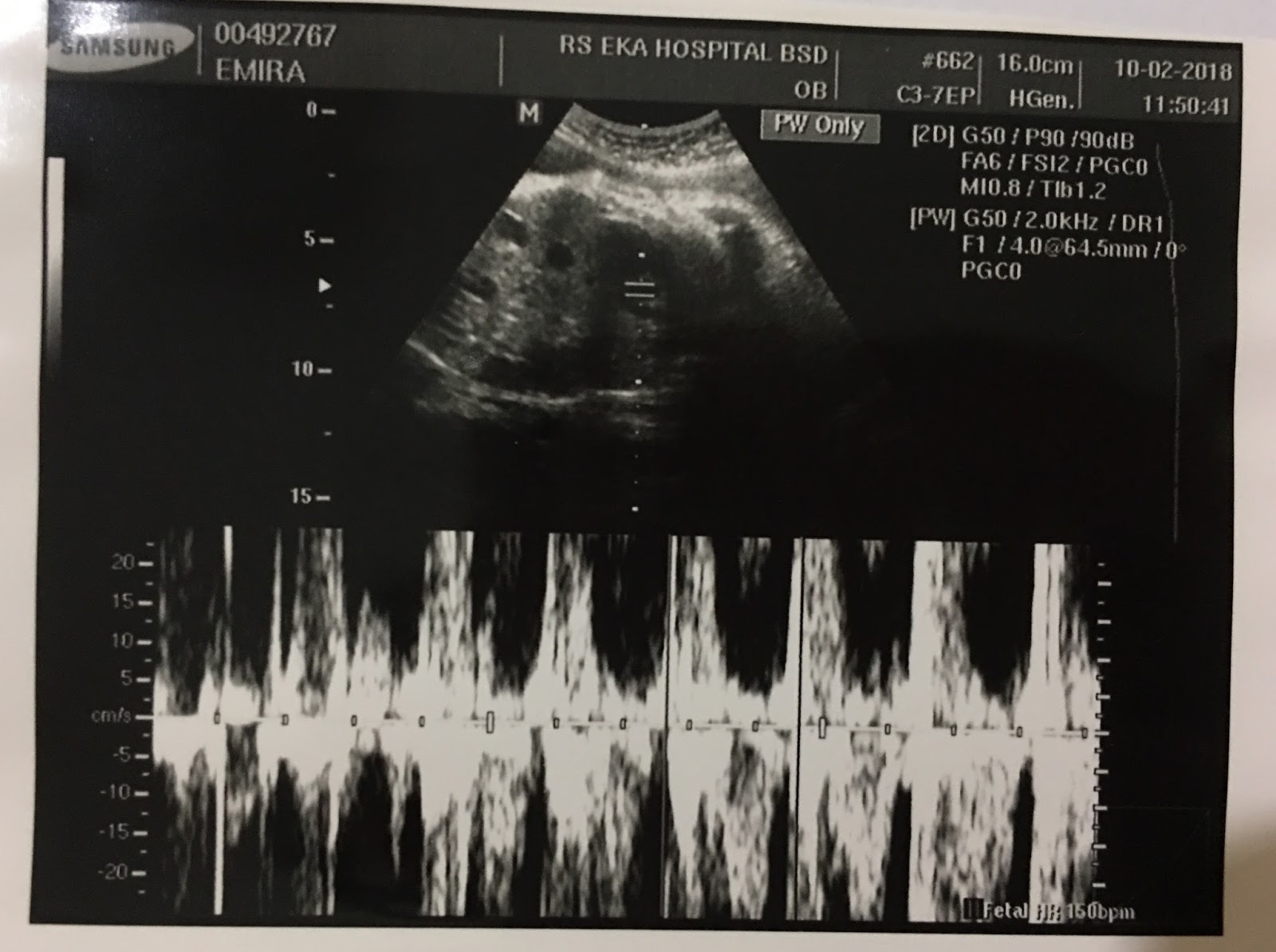 Story of My Journey: USG Kehamilan 37 Minggu