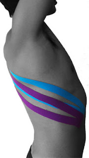 ARES Kinesiology Tape: Intercostal Neuralgia