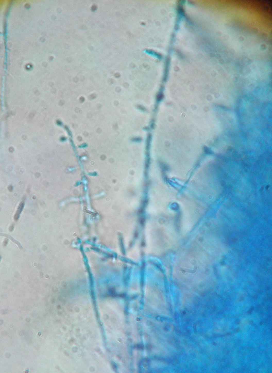 ATLAS MICOLOGIA: TRICHOPHYTON INTERDIGITALE