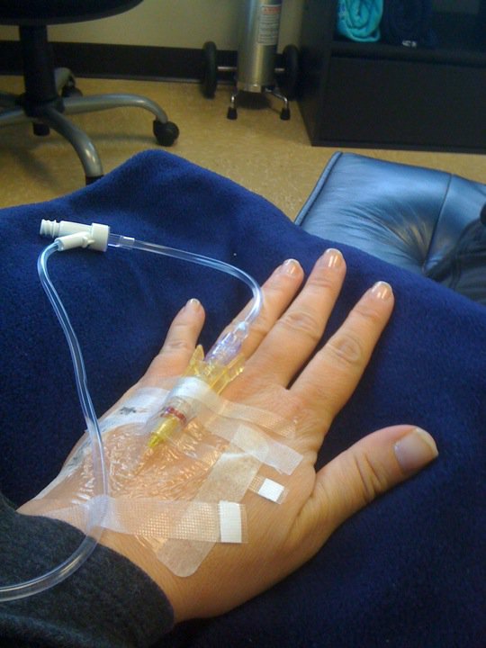 Sausage toes and scales. Living life with Psoriatic Arthritis ...