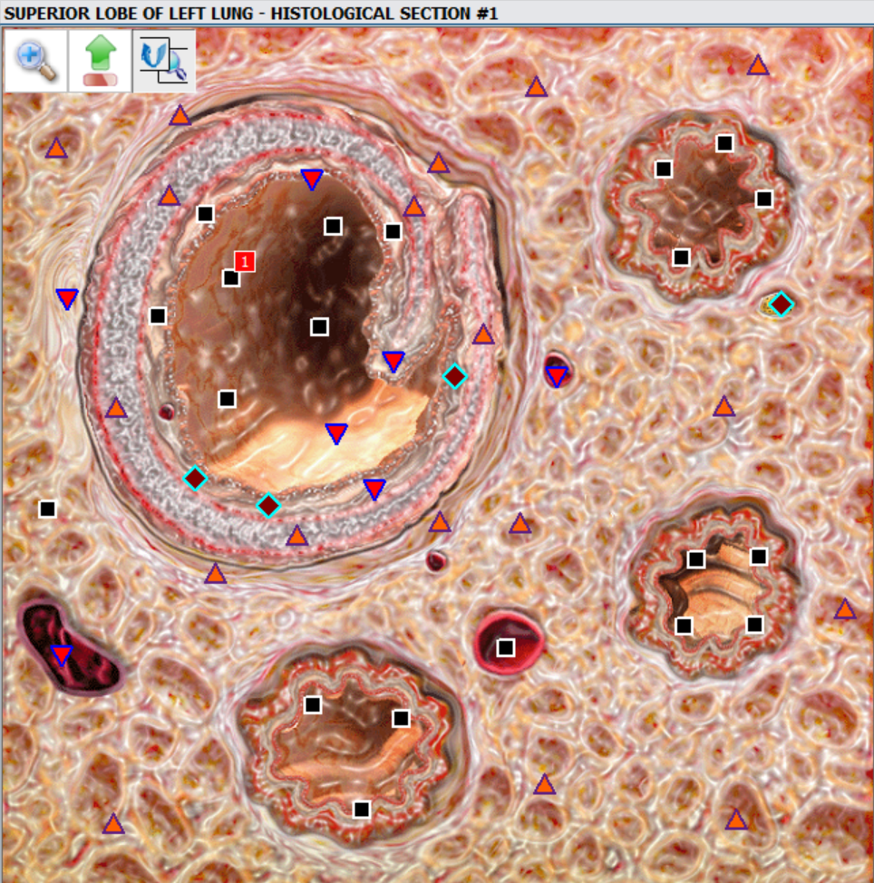 Ο ΚΑΡΚΙΝΟΣ ΤΟΥ ΠΝΕΥΜΟΝΑ, ΟΙ ΠΑΡΑΓΟΝΤΕΣ ΚΙΝΔΥΝΟΥ ΚΑΙ Η ΚΑΛΥΤΕΡΗ ΠΡΟΛΗΨΗ ...