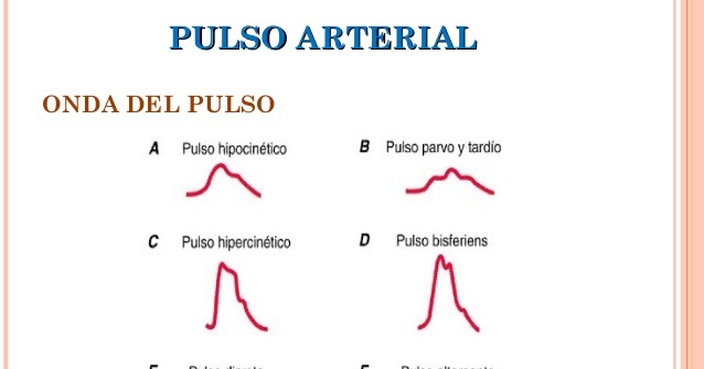 PULSO ARTERIAL NORMAL