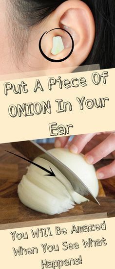 This Is What Happen When You Put Cut Up Onion Inside Your Ear - Health ...