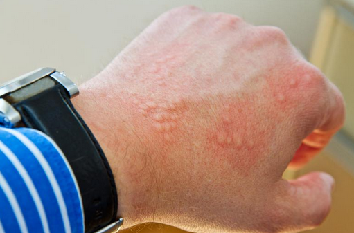 Life cycle of Human Hookworms - CONFIRM INFOZ