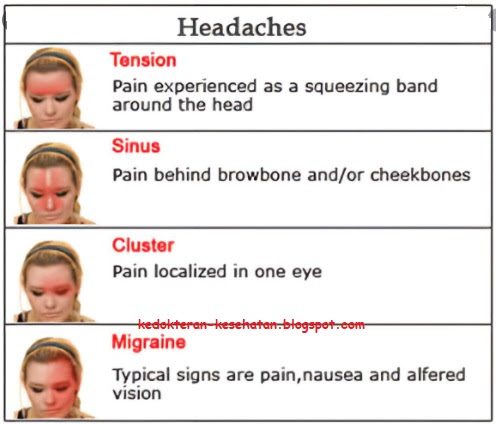 Mengenali Penyebab, Gejala, dan Cara Mengobati Cephalgia - KLIK INSTAL