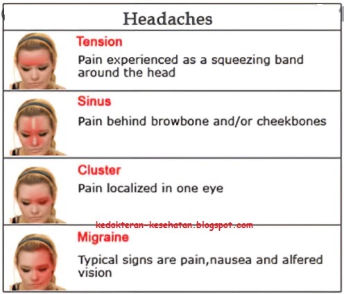 Mengenali Penyebab, Gejala, dan Cara Mengobati Cephalgia - KLIK INSTAL
