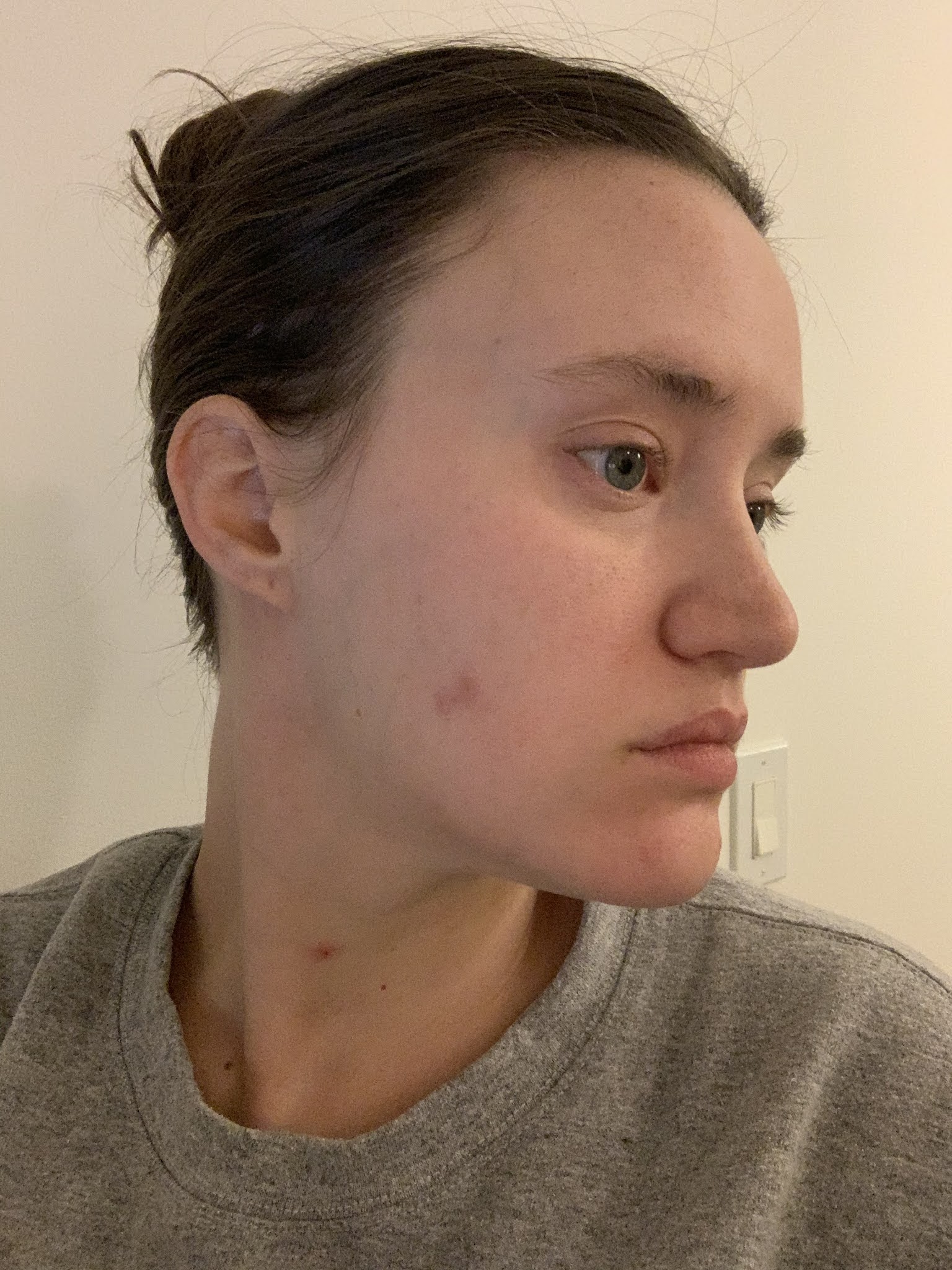 My Differin Review | Connecticut Fashion and Lifestyle Blog | Covering ...