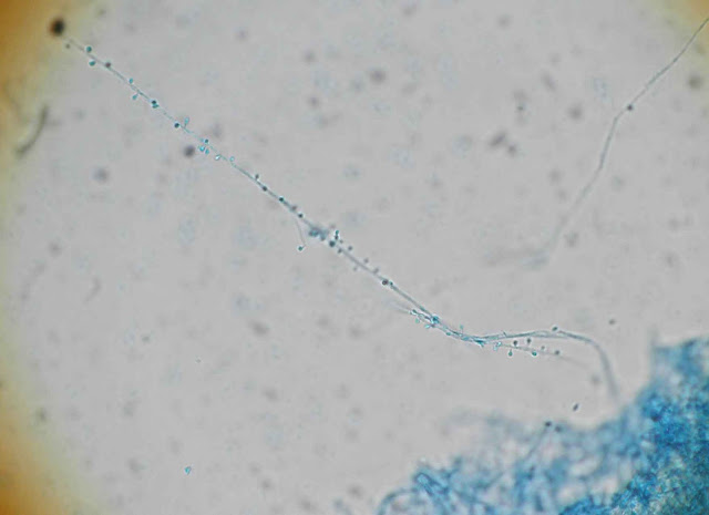 ATLAS MICOLOGIA: TRICHOPHYTON RUBRUM