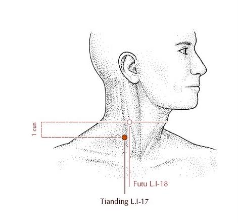 Acupuncture: LI - 17 (Large Intestine-17)
