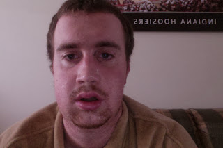 Double Jaw Surgery (Lefort I Advancement Bilateral BSSO (Bilateral ...