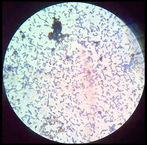 Aeromonas hydrophila; Klasifikasi, Morfologi, Habitat, Etc - Melek ...