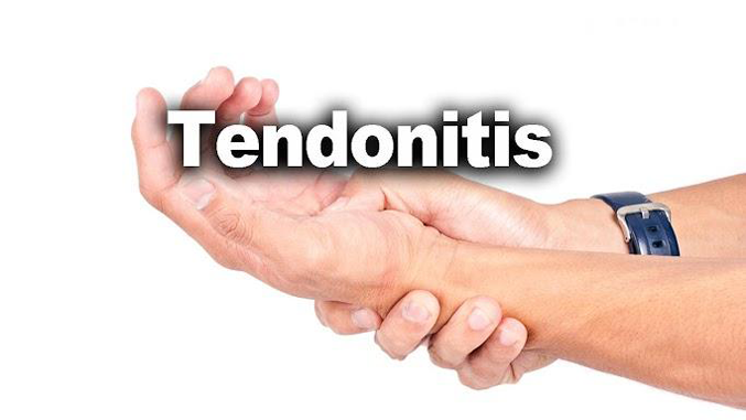 Cara Menyembuhkan Tendinitis (Radang Tendon) | Cara Mengobati Penyakit ...