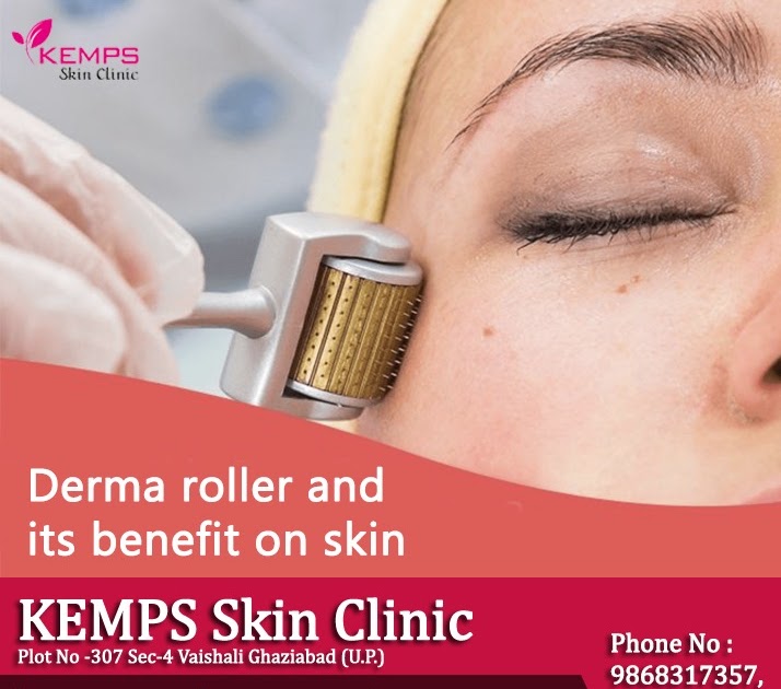 What is Derma roller and what is its benefit on skin? | KEMPS Skin Clinic