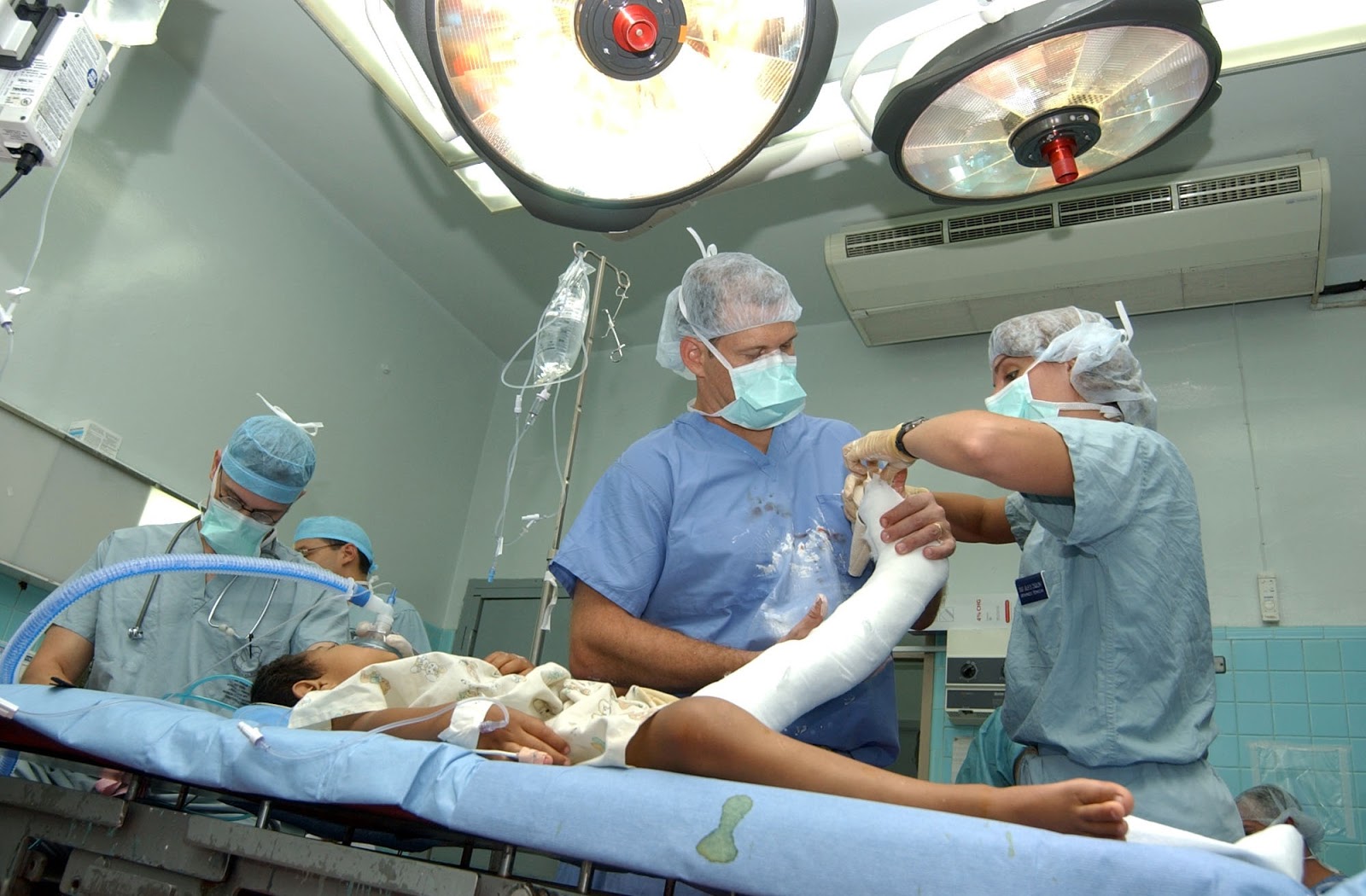Broken Bones Fracture Causes Symptoms Types Treatment broken-bones-fracture-causes-symptoms-types-treatment