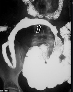 PROTOCOLO DE ESTUDIOS ESPECIALES: TRÁNSITO INTESTINAL