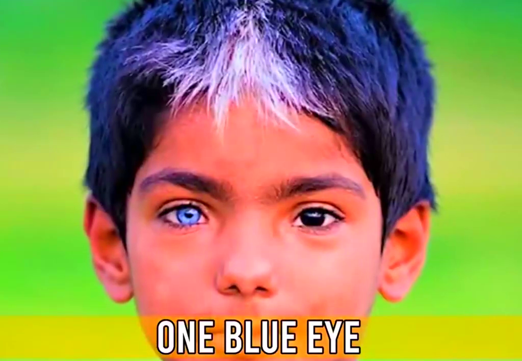 10 Most Unique And Unusual People in the World Rare Humans That Are one ...