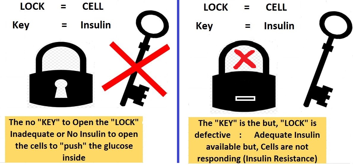 Fat Protein Carb's: Diabetes Mellitus