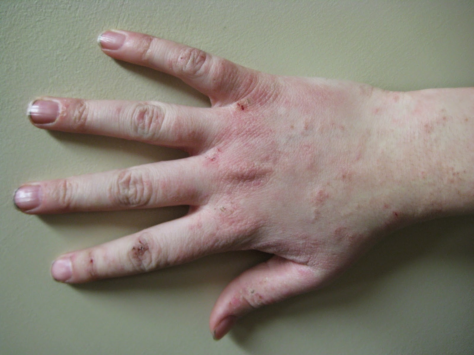 JohnWoon(JW)Latex Consultants