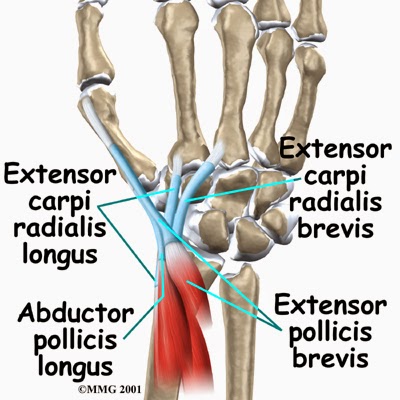 Medische Kennis: Roeierspols (intersection syndrome, oarsman's wrist)