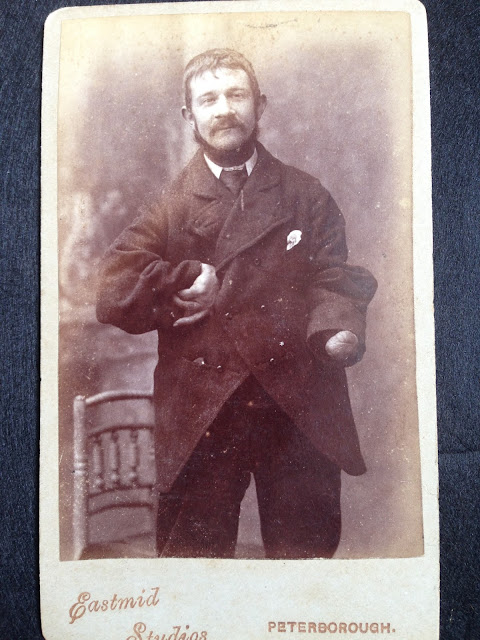 Anthony Rhys: Victorian Photographs of Disability