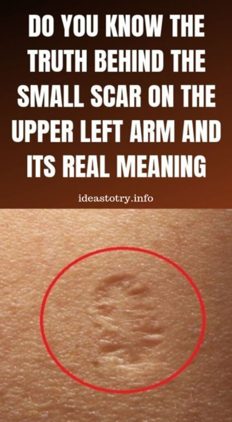 Ever wondered what that scar on your left shoulder means? - medicine ...